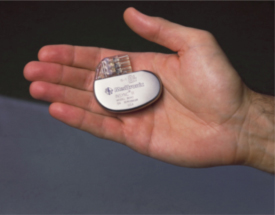 Pacemakers And Other Heart Devices | London Keyhole Heart Clinic