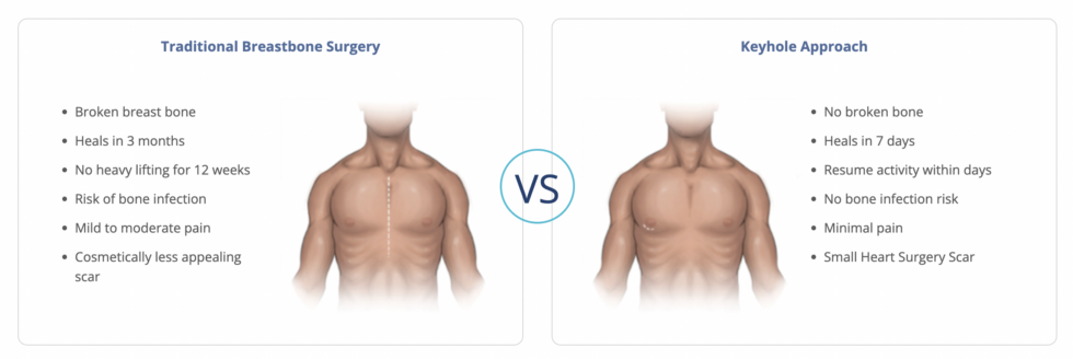 Alternative To Open Heart Surgery | Keyhole Heart Clinic UK